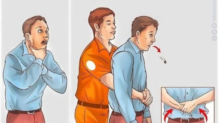 Heimlich Manevrası Nedir ve Nasıl Yapılır? - TechnoLogic